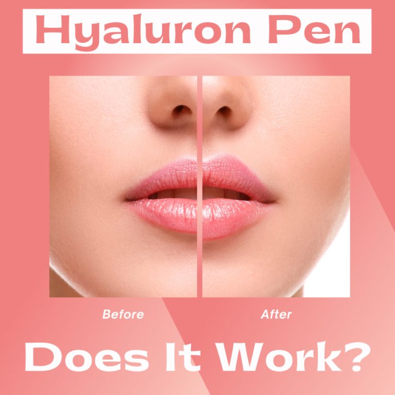 I Tried The Hyaluron Pen And This Is What Happened... 2023 - Shop With ...