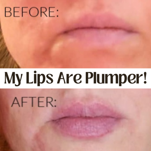 I Tried The Hyaluron Pen And This Is What Happened... 2025 - Shop With ...